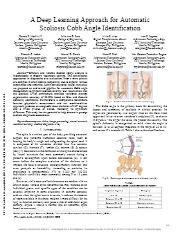 A Deep Learning Approach for Automatic Scoliosis Cobb Angle Identification